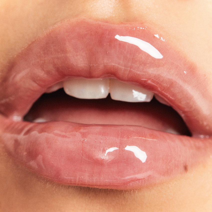 Volume Lip Gloss with Shea Butter for Soft Lips | Smooche